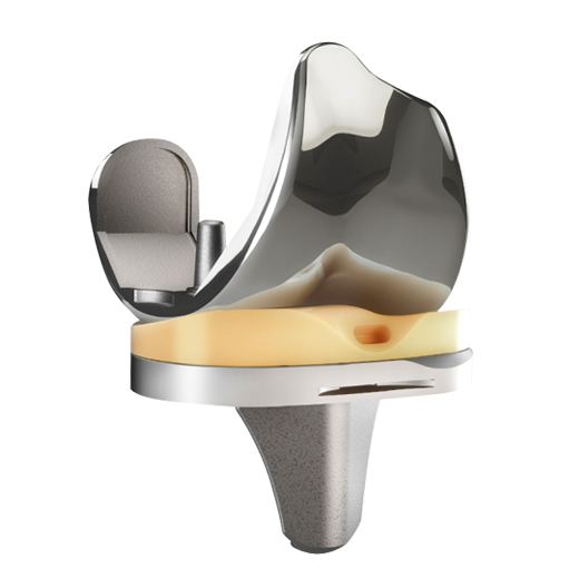 Prótesis para remplazo total de rodilla primario 3D - Daonsa Implantes